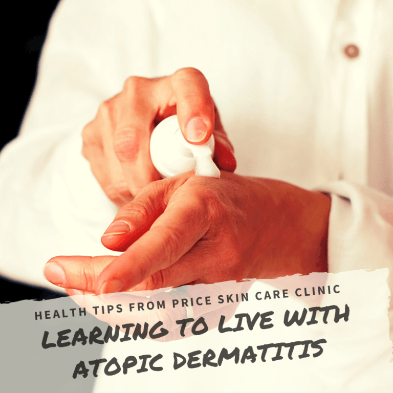 Learning to Live with Atopic Dermatitis | Price Skin Care